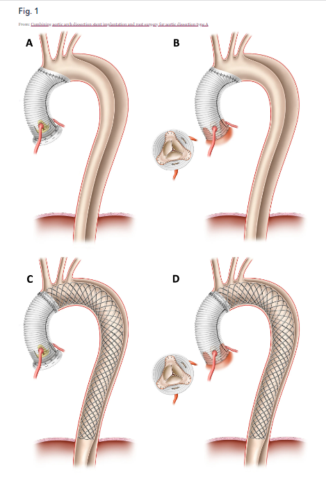 Home page | Journal of Cardiothoracic Surgery