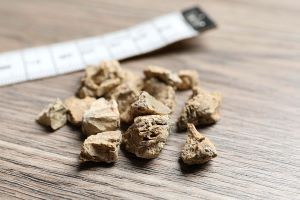 Modern diagnostics and treatment modalities for urolithiasis