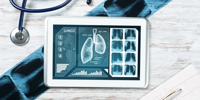 Call for papers - Artificial intelligence and tuberculosis screening