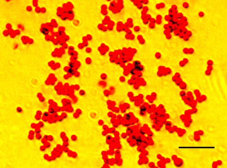 Identification of polyhydroxyalkanoates in Halococcus and other ...