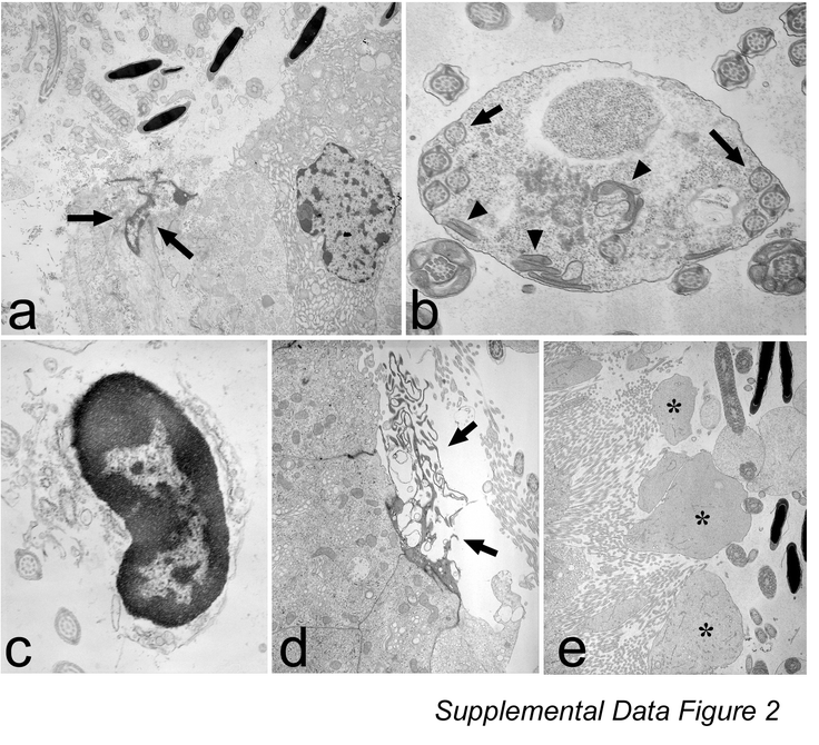 Altered epididymal sperm maturation and cytoplasmic droplet migration ...