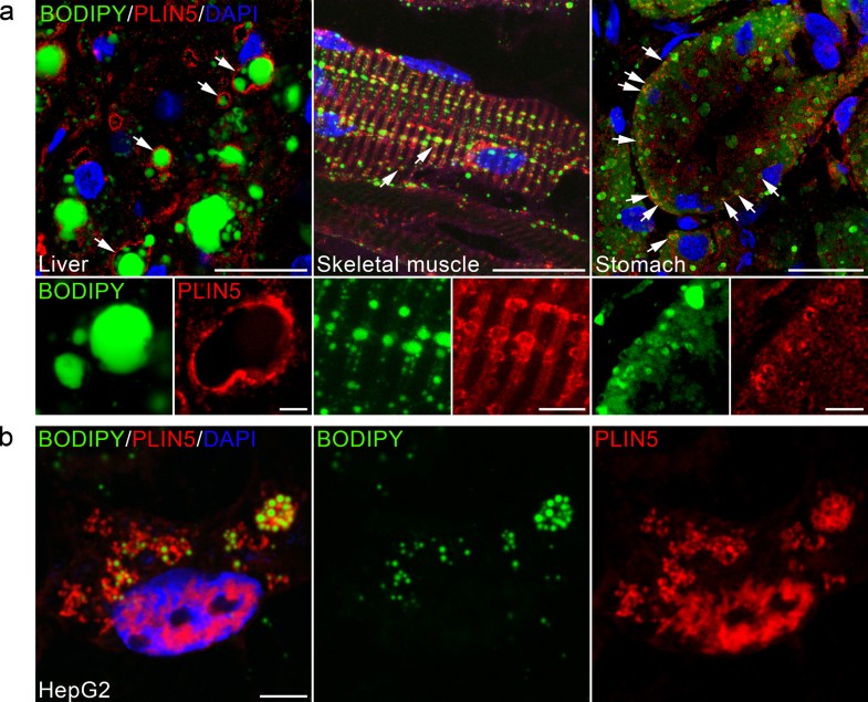 Widespread expression of perilipin 5 in normal human tissues and in ...