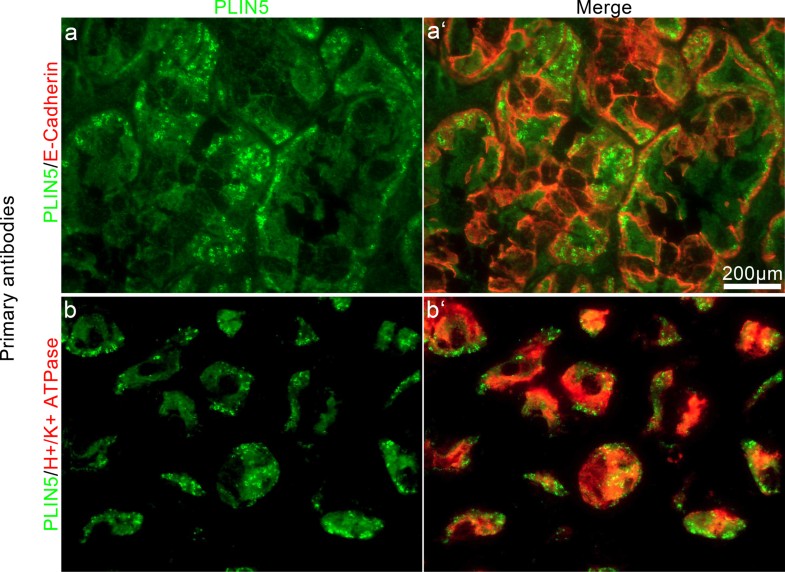 Widespread expression of perilipin 5 in normal human tissues and in ...