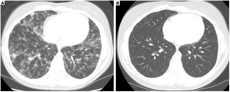 Use of Combination Chemotherapy for Treatment of Granulomatous and ...