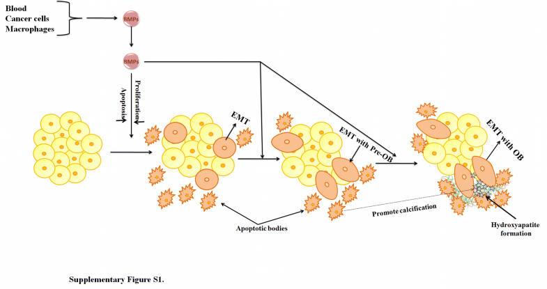 A Molecular View of Pathological Microcalcification in Breast Cancer ...