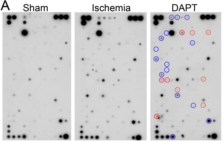 Acute Blockage of Notch Signaling by DAPT Induces Neuroprotection and ...