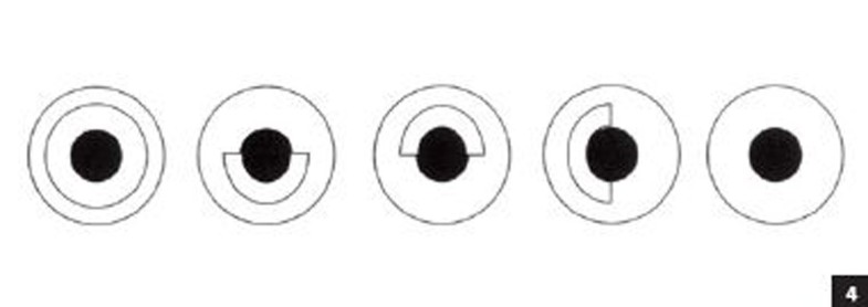 De ferrule-rule aan de tand gevoeld | SpringerLink