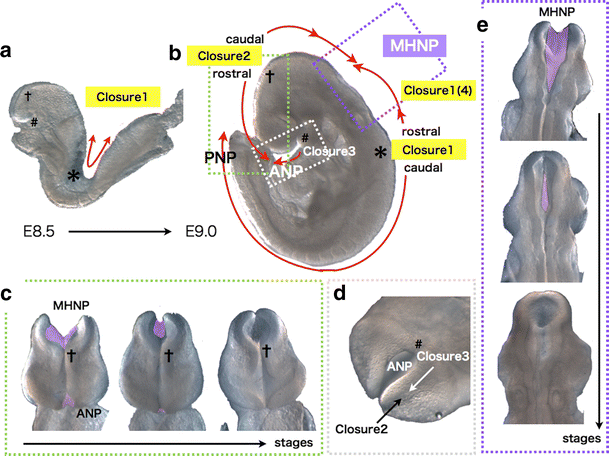 How to form and close the brain: insight into the mechanism of cranial ...