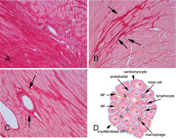 The pathogenesis of cardiac fibrosis | SpringerLink