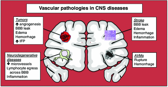Developmental and pathological angiogenesis in the central nervous ...