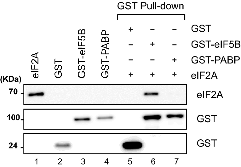 eIF2A, an initiator tRNA carrier refractory to eIF2α kinases, functions ...