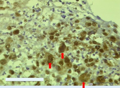 Proktitis – aus gastroenterologischer Sicht | SpringerLink