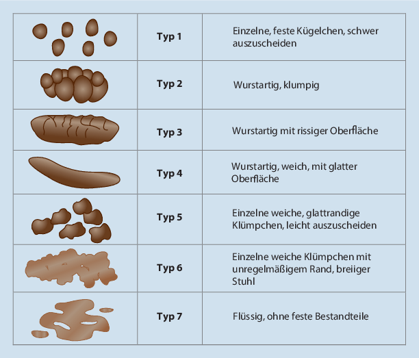 Obstipation | SpringerLink