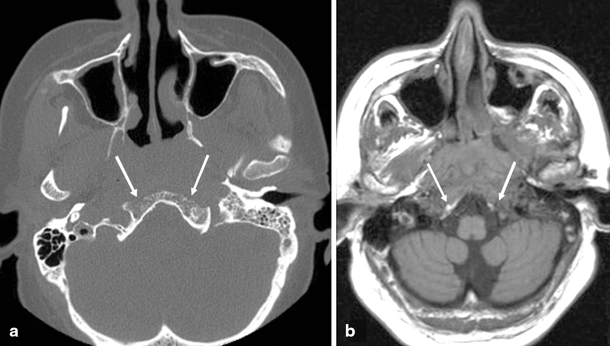 The Clivus | SpringerLink