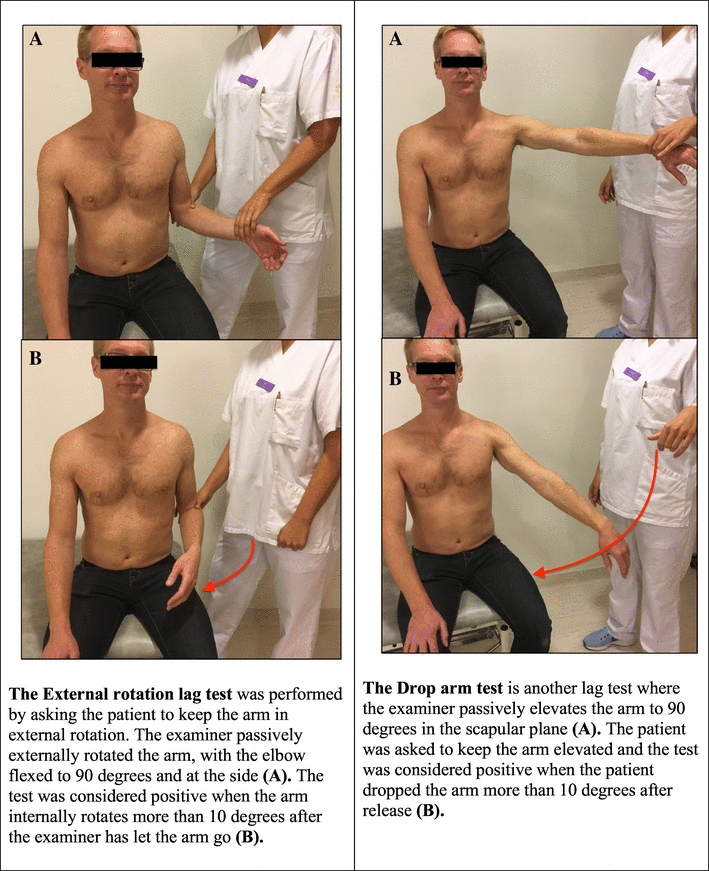 Physical therapists as first-line diagnosticians for traumatic acute ...