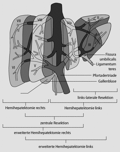 Technik der Leberresektion | Springer for Research & Development