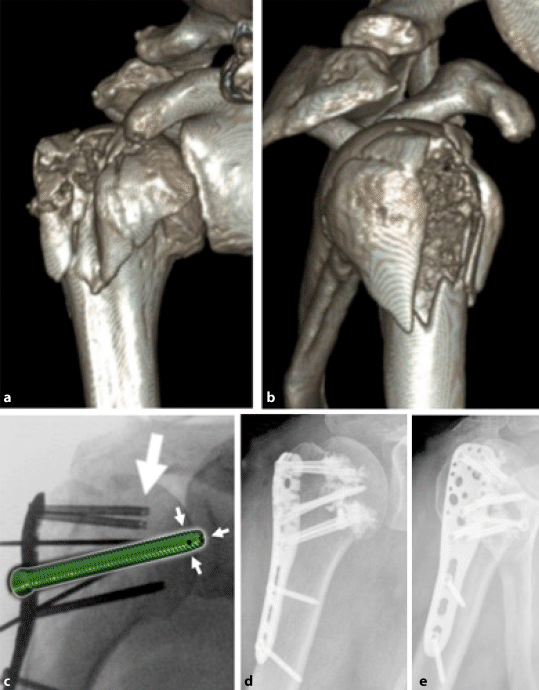 Alterstraumatologie | SpringerLink