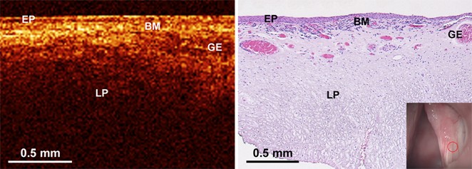 Optische Kohärenztomographie | SpringerLink