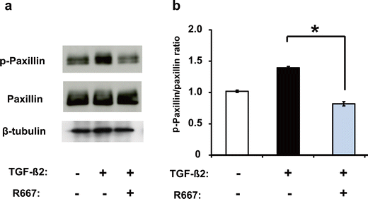 Attenuation of EMT in RPE cells and subretinal fibrosis by an RAR-γ ...