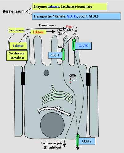 Laktose- und Fruktosemalabsorption | SpringerLink