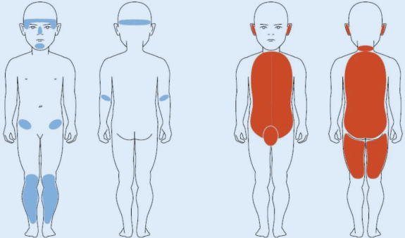 Früherkennung von Kindesmisshandlung | SpringerLink