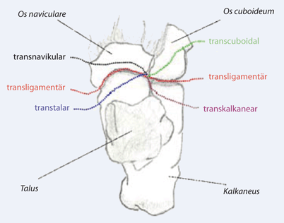 Chopart-Luxation – eine einfache Diagnose? | SpringerLink