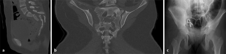 Das Polytrauma im Kindesalter | SpringerLink