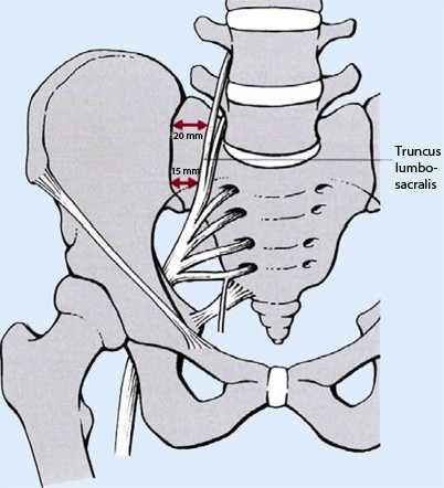 Anteriore Zugänge zum Beckenring | SpringerLink