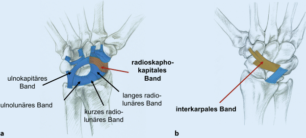 Mediokarpale Instabilitäten der Handwurzel | SpringerLink