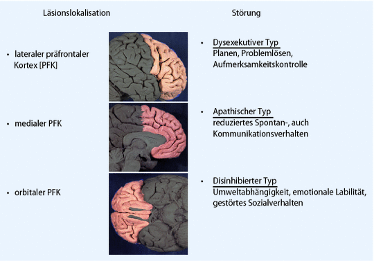 Kognitive Hirnleistungen des präfrontalen Kortex | SpringerLink