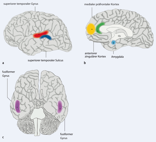 Bildgebung bei Autismusspektrumstörungen | SpringerLink