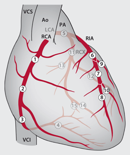 Koronare Herzcomputertomographie | SpringerLink