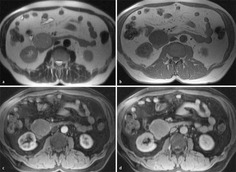 Radiologische Diagnostik des Dünndarms | SpringerLink