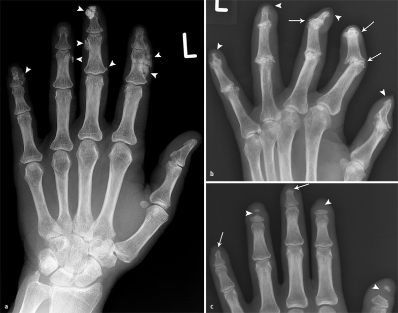 Bildgebung rheumatischer Erkrankungen | SpringerLink