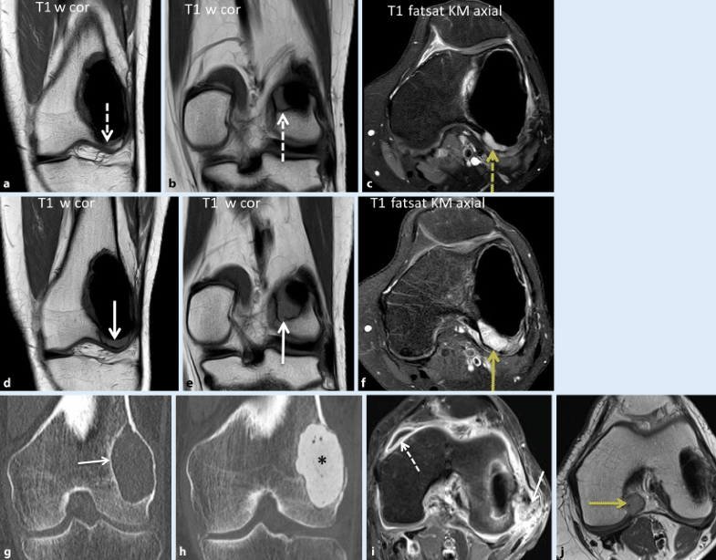 Postoperative und posttherapeutische Veränderungen nach primären ...
