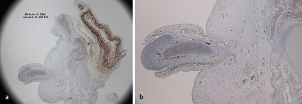 Phimose | SpringerLink