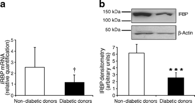 Interphotoreceptor retinoid-binding protein (IRBP) is downregulated at ...