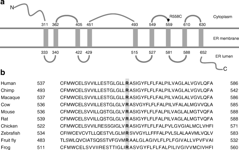 Identification of a missense variant in the WFS1 gene that causes a mild form of Wolfram ...
