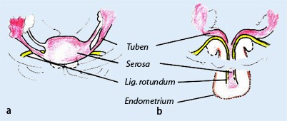 Inversio uteri | SpringerLink