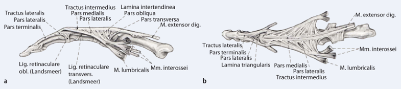 Die traumatische Knopflochdeformität | SpringerLink