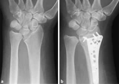 Fehlbildungen an Hand und Unterarm | SpringerLink