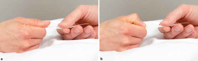 Klinische Untersuchung des Handgelenkes und der Hand | SpringerLink