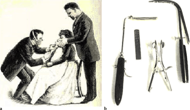 A brief history of tracheostomy and tracheal intubation, from the ...