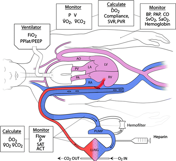 Contemporary extracorporeal membrane oxygenation for adult respiratory ...