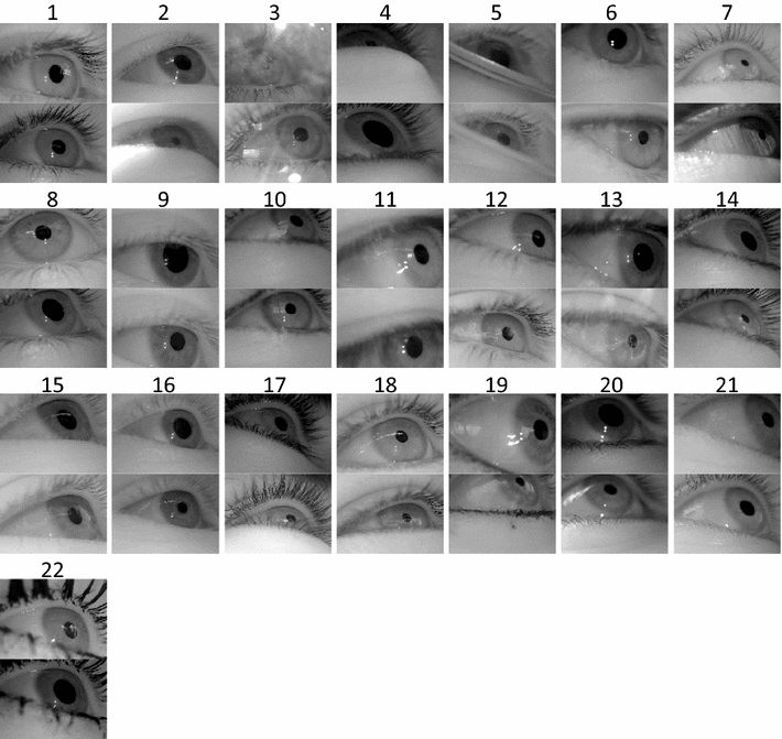 Fast and robust ellipse detection algorithm for head-mounted eye ...