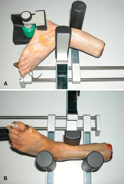 Biomechanical evaluation against calcaneofibular ligament repair in the ...