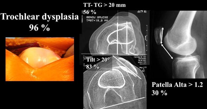 The patellofemoral joint and its historical roots: the Lyon School of ...