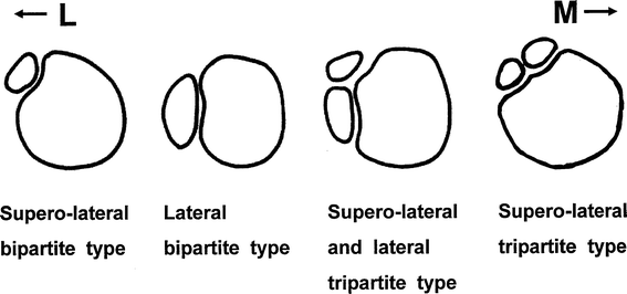Developmental anomaly of ossification type patella partita | SpringerLink