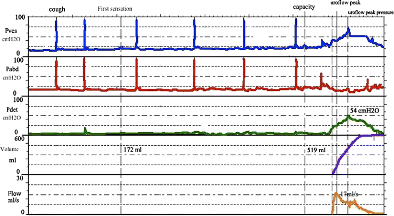 Normal urodynamic parameters in women | SpringerLink