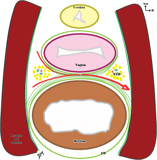 Concepts of the rectovaginal septum: implications for function and ...